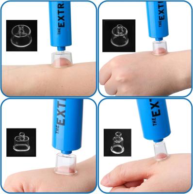 China Portable EVA First Aid Kit with Zipper Closure and Four Extraction Cup Sizes for Snake Bites and Bee Stings for sale