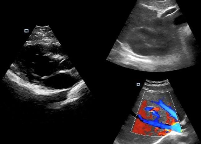 Color Doppler Ultrasound Probe Handheld Ultrasound Device For Mobilephone / PC