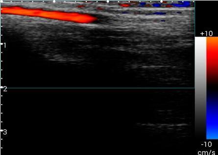 Portable Doppler Ultrasound Machine Color Doppler Ultrasound Scanner With 6 Inch Full Touch Screen