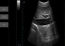 Ultrasound Scan Equipment Portable Ultrasound Scanner Palm Ipad Ultrasound Machine