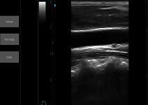 Ultrasound Scan Equipment Portable Ultrasound Scanner Palm Ipad Ultrasound Machine