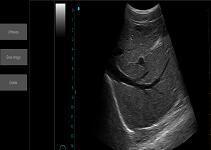 Ultrasound Scan Equipment Portable Ultrasound Scanner Palm Ipad Ultrasound Machine