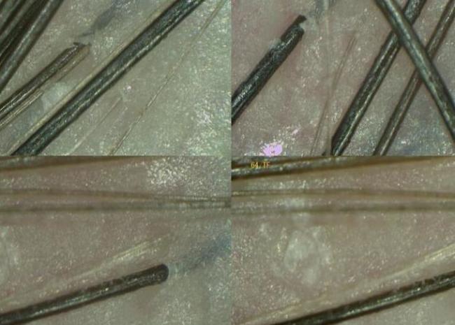 Facial Skin Analysis Equipment Built - In LED Light Source 4 Or 9 Images Displaying