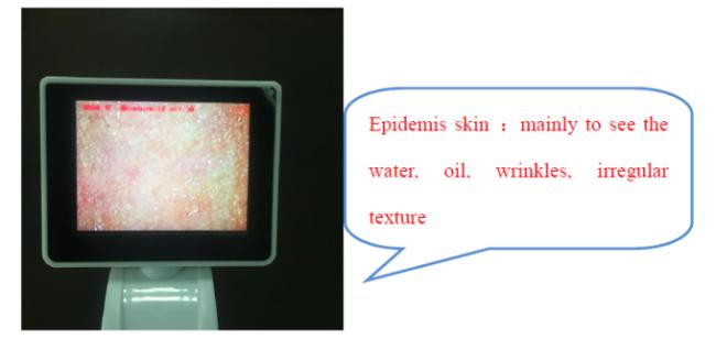 CE BS5SH Digital Skin Analyzer Digital Skin Moisture Meter For Doctor