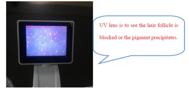 CE BS5SH Digital Skin Analyzer Digital Skin Moisture Meter For Doctor