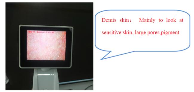 CE BS5SH Digital Skin Analyzer Digital Skin Moisture Meter For Doctor