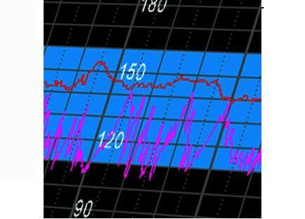 Hospital Vital Signs Monitor Multi Parameter Patient Monitor Fetal Maternal Monitor With 12.1" TFT Color Screen