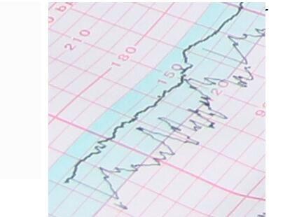Hospital Vital Signs Monitor Multi Parameter Patient Monitor Fetal Maternal Monitor With 12.1" TFT Color Screen