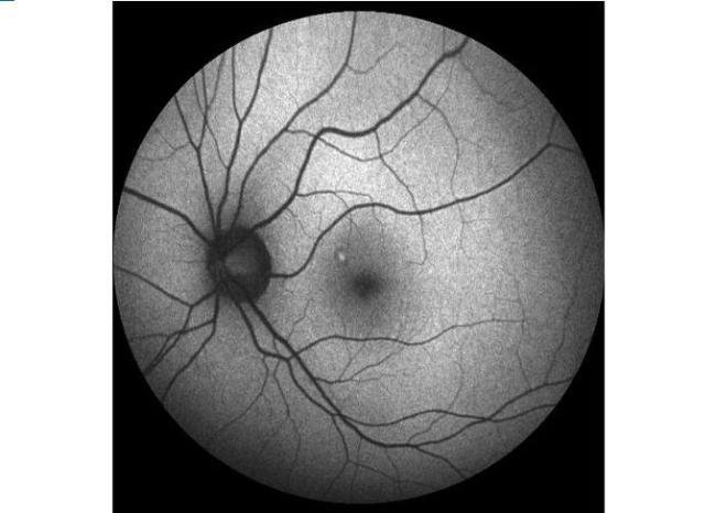 attrezzatura oftalmica Ultra di ampiezza di Angiograph Digital della retina di esame del laser del campo con lo zoom ottico 100°/60°/30°