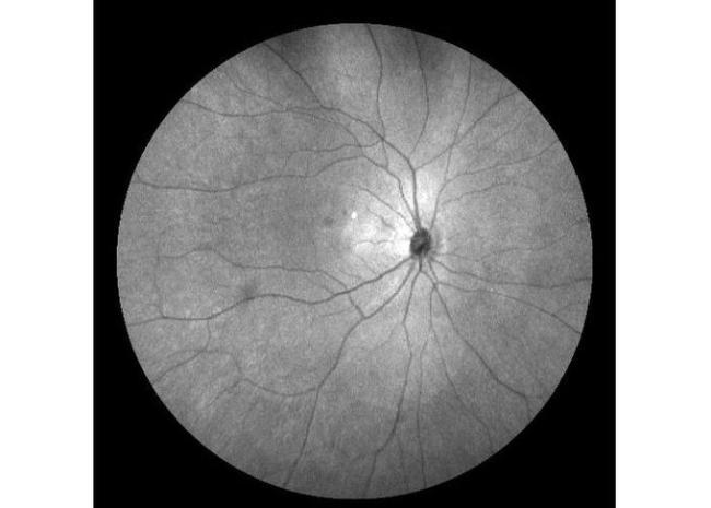 attrezzatura oftalmica Ultra di ampiezza di Angiograph Digital della retina di esame del laser del campo con lo zoom ottico 100°/60°/30°