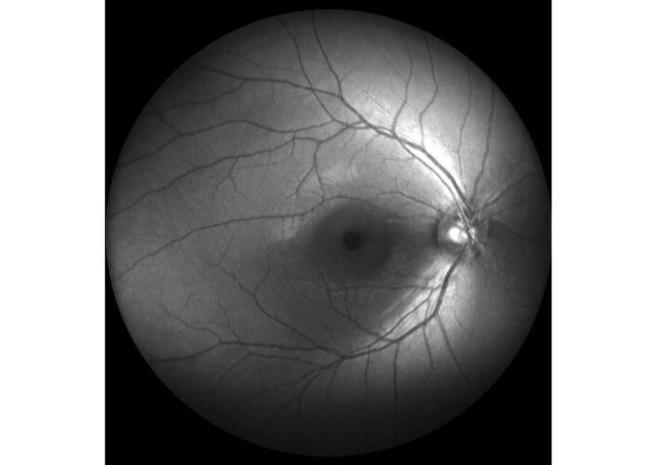 attrezzatura oftalmica Ultra di ampiezza di Angiograph Digital della retina di esame del laser del campo con lo zoom ottico 100°/60°/30°