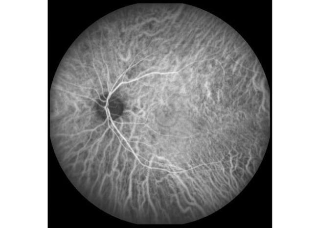 attrezzatura oftalmica Ultra di ampiezza di Angiograph Digital della retina di esame del laser del campo con lo zoom ottico 100°/60°/30°