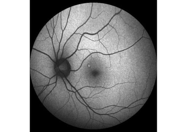attrezzatura oftalmica Ultra di ampiezza di Angiograph Digital della retina di esame del laser del campo con lo zoom ottico 100°/60°/30°