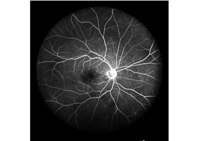 attrezzatura oftalmica Ultra di ampiezza di Angiograph Digital della retina di esame del laser del campo con lo zoom ottico 100°/60°/30°