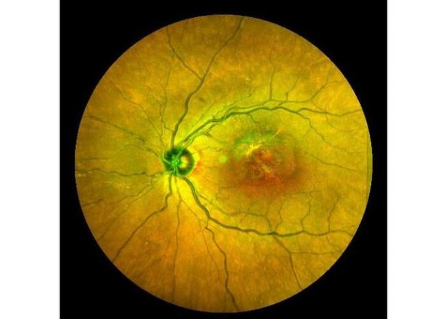 attrezzatura oftalmica Ultra di ampiezza di Angiograph Digital della retina di esame del laser del campo con lo zoom ottico 100°/60°/30°