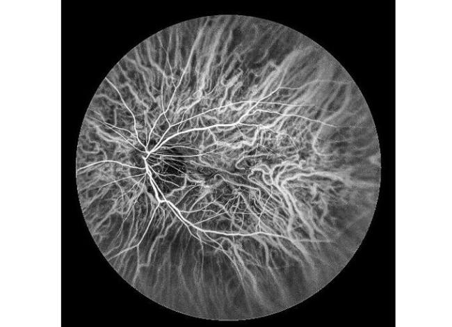 attrezzatura oftalmica Ultra di ampiezza di Angiograph Digital della retina di esame del laser del campo con lo zoom ottico 100°/60°/30°