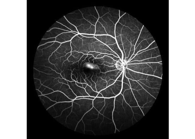 attrezzatura oftalmica Ultra di ampiezza di Angiograph Digital della retina di esame del laser del campo con lo zoom ottico 100°/60°/30°