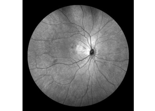 attrezzatura oftalmica Ultra di ampiezza di Angiograph Digital della retina di esame del laser del campo con lo zoom ottico 100°/60°/30°