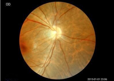 Sistema di Android per la macchina fotografica tenuta in mano del fondo di operazione più facile con risoluzione di immagine minima dell'allievo 2.5mm 1920x1080