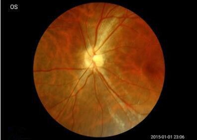 Sistema di Android per la macchina fotografica tenuta in mano del fondo di operazione più facile con risoluzione di immagine minima dell'allievo 2.5mm 1920x1080