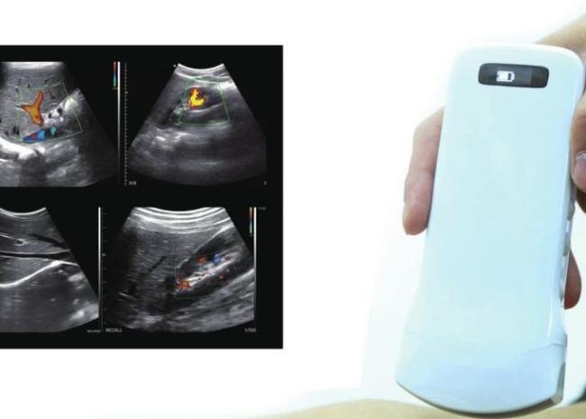 Mini Handheld Ultrasound Scanner Portable Color Doppler With Multi-Frequency 2-10MHz 128 Elements 64 Channels 4