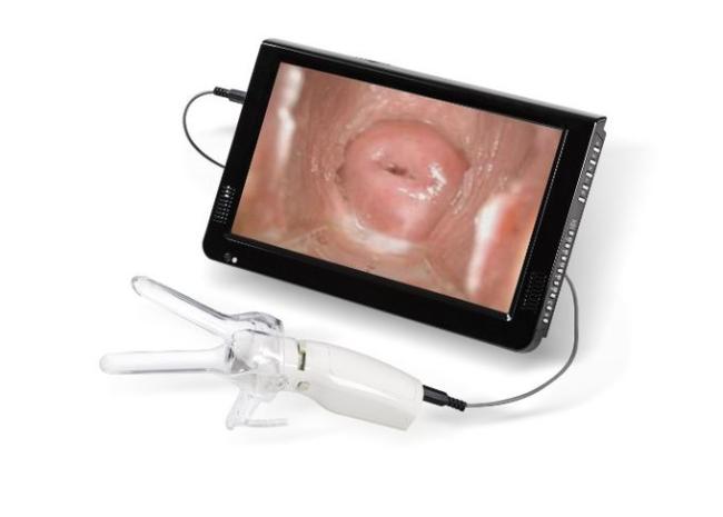 Colposcope elettronico 3 di Digital dell'alto di definizione delle donne dell'esame di coscienza dell'endoscopio segnale di avoirdupois (video)