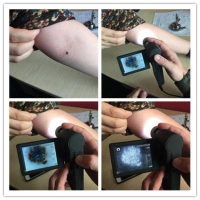 China Portable Handheld Microscope Digital Skin Hair Inspector with Measurement Software in PC for sale