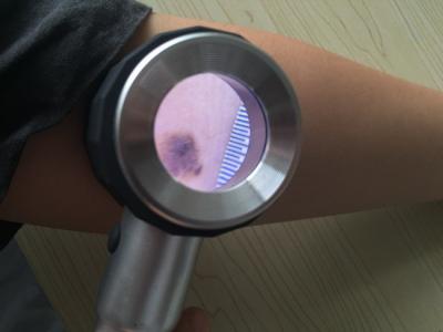 China 10 Times Magnification Handheld Dermatoscope OEM or Customized Available for sale