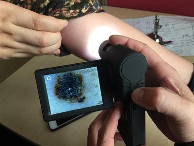 China Silicon Rubber Skin Microscope Camera Video Dermatoscope Li Ion Rechargeable Battery 20~230 Times Magnification for sale