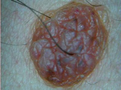 China Handheld Dermal Videoscope Skin Analyer With WIFI Connection And High Image Video Resolution for sale