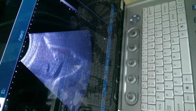 China PC basierte B/tragbaren Ultraschall-Scanner W Gewicht 15 das Zoll Laptop-Schirm-nur 5kgs, das bequem ist zu tragen zu verkaufen