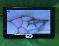 China Portable Digital Electronic Colposcope for sale