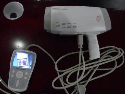 China Handheld Video Digital Electronic Colposcope With High-Resolution 80,0000 Pixels Vagina Camera Cervix Camera for sale