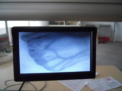 China Portable Flexible Screen Venipuncture Device Infrared Vein Finder / Vein Locator for sale