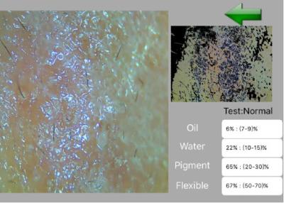 Cina Colposcope elettronico di portata medica di Digital capelli/della pelle mini con USB/avoirdupois di uscita in vendita