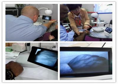 中国 800*480決断のゆとりの静脈イメージ投射静脈の視聴者の探知器 販売のため