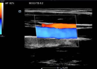중국 소형 무선 손 초음파 기계 유효한 안드로이드 Windows IOS 체계 판매용