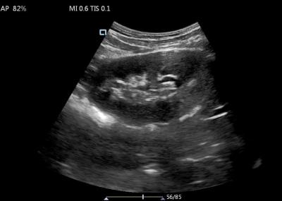 중국 소형 무선 손 초음파 기계 유효한 안드로이드 Windows IOS 체계 판매용