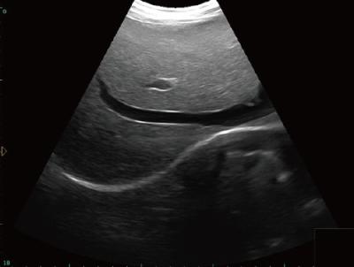 China 12 Inch LED Diagnostic Medical Ultrasound Laptop Ultrasound Scanner With One Probe Connect Vet Software Available for sale