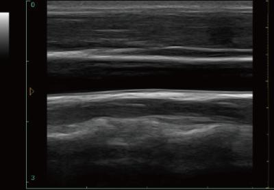 China 12 Inch LED Diagnostic Medical Ultrasound Laptop Ultrasound Scanner With One Probe Connect Vet Software Available for sale