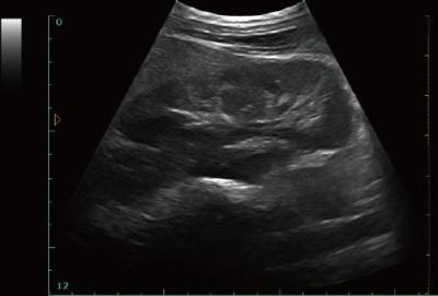 China 12 Inch LED Diagnostic Medical Ultrasound Laptop Ultrasound Scanner With One Probe Connect Vet Software Available for sale