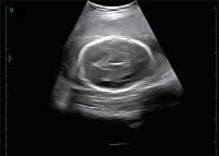 China B/W Portable Ultrasound Scanner BIO 3000J Frequency Conversion Notebook for sale