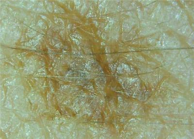 China Handheld Dermal Videoscope Skin Analyer With WIFI Connection And High Image Video Resolution for sale