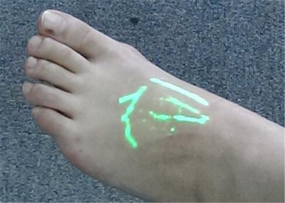China For Venipuncture Use Infrared Vein Finder Medical Vein Locator to Help Nurse to Find Vessal for sale
