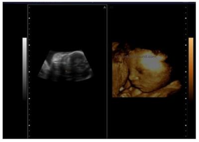 China 4D Function Optional Laptop Hand Held Doppler Machine With Transducer 2~12MHz for sale