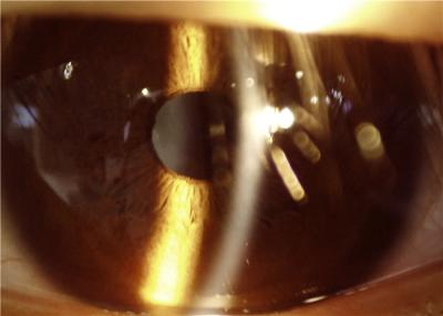 China Handheld Slit Lamp 16G Digital Fundus Camera 80000 Images for sale