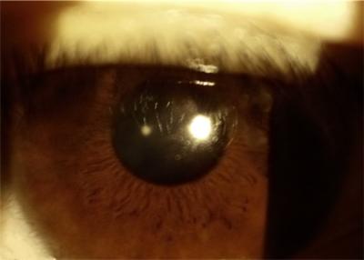 China Handheld Slit Lamp 16G Digital Fundus Camera 80000 Images for sale