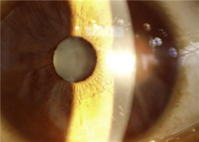 China Handheld Slit Lamp 16G Digital Fundus Camera 80000 Images for sale