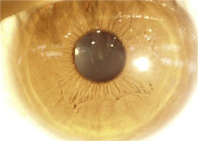 China Handheld Slit Lamp 16G Digital Fundus Camera 80000 Images for sale