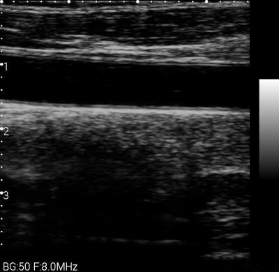 중국 6 인치 LCD 터치스크린을 가진 이동할 수 있는 가득 차있는 디지털 방식으로 휴대용 초음파 기계 무선 판매용